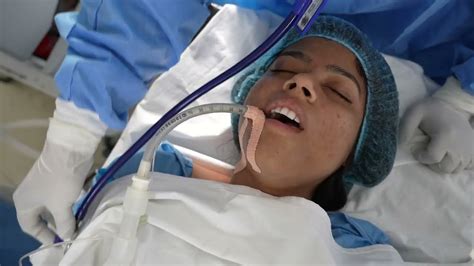 Image result for Intubation Real