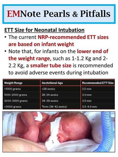 Image result for Neonatal Intubation