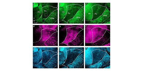 Image result for The Human Brain Map Project