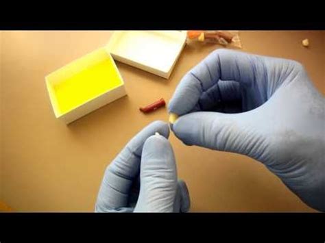 Image result for DIY Tooth Bridge Kit