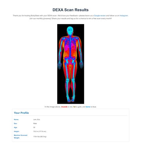 Image result for Dexa Scan Example