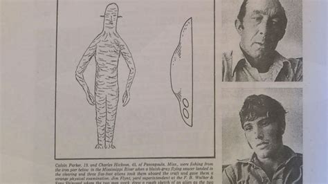 Image result for Alien Female Abduction Needle Examination