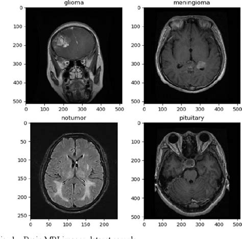 Image result for Brain Tumor Classification Flutter UI