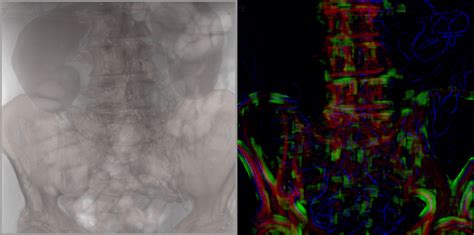 Image result for Sparse Depth Estimation