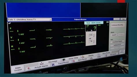 Image result for Basic Telemetry