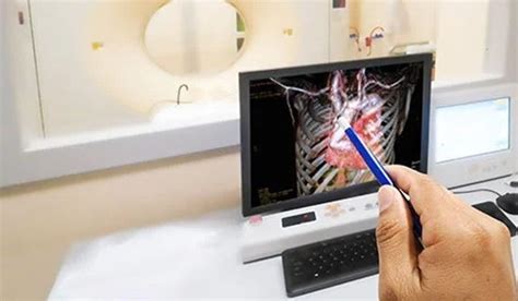 Image result for Different Types of Angiogram