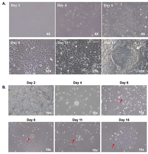 Image result for IPSC Reprogramming