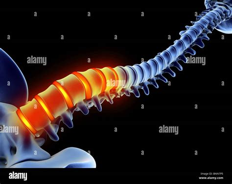 Image result for Back Pain in Computer