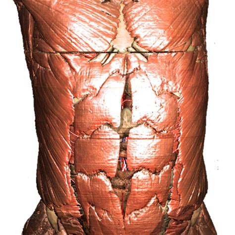 Image result for Virtual Human Body Dissection