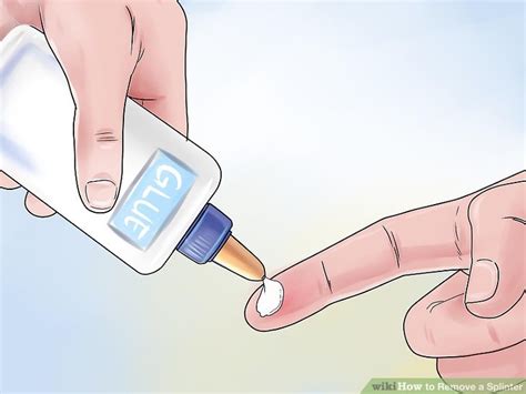 Image result for Drawing Ointment to Remove Splinter