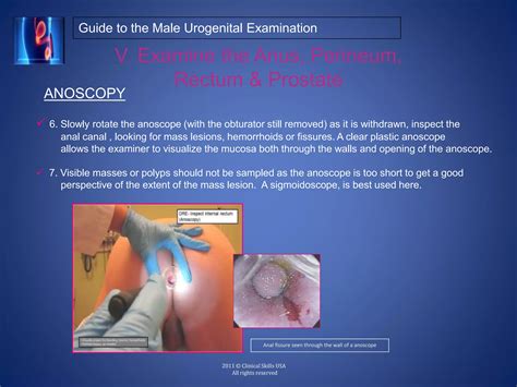 Image result for Urogram Exam