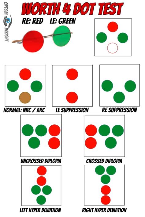 BRUCKNER TEST (FUNDUS RED REFLEX TEST) - OptomInSight
