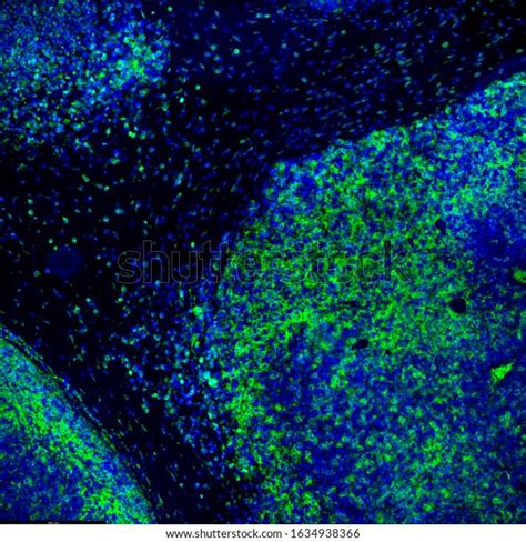 Image result for Multiplex IHC