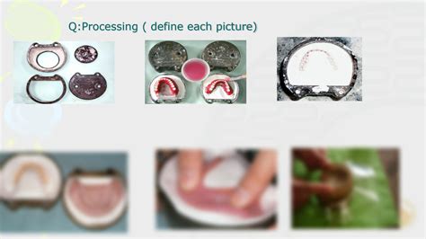 Image result for How to Process a Denture