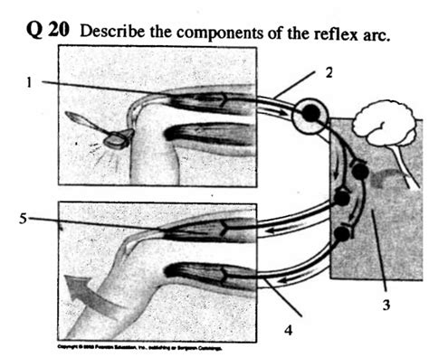 Image result for Components of Reflex Arc