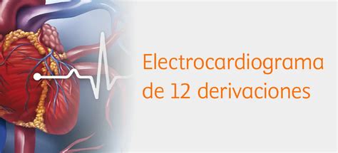 Image result for ECG 12 Derivaciones Normal