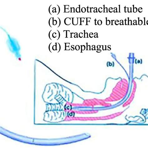 Image result for Intubation Steps
