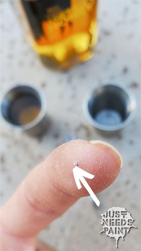 Image result for Drawing Ointment to Remove Splinter