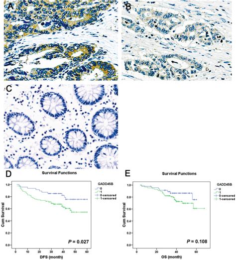 Image result for Tissue Microarray Multiplex IHC NCR
