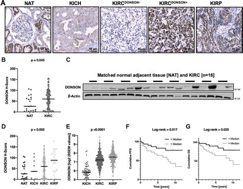 Image result for Tissue Microarray Multiplex IHC NCR