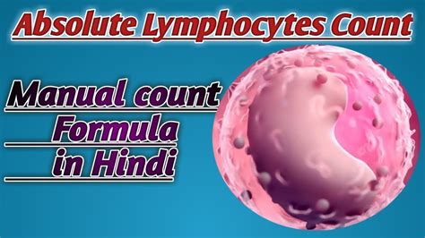 Image result for Lymphs Absolute High Count