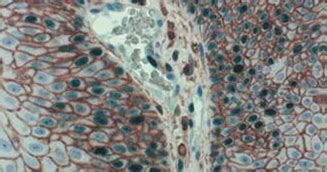 Image result for Multiplex IHC Kit