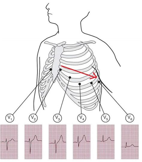 Image result for ECG 12 Derivaciones Normal