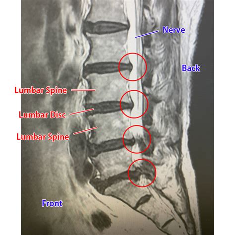 Image result for Discus Block Leg