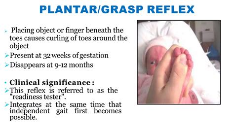 Image result for Neonatal Primitive Reflexes