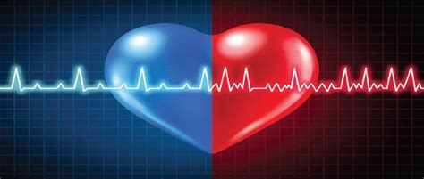 Image result for Atrial Flutter Loop Recorder