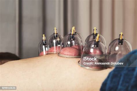 Image result for Using a Vacuum Cup to Poop