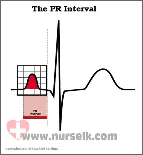 Image result for PR Interval ECG Boxes