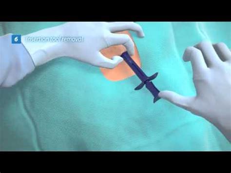 Image result for LINQ Loop Recorder