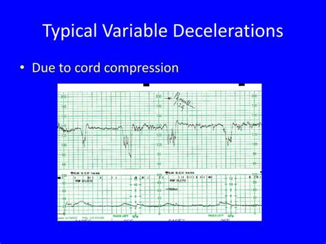 Image result for Variable Decelerations