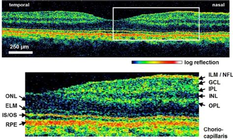 Image result for Oct Axial Resolution