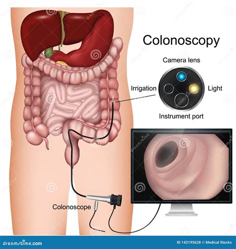 Image result for Colonoscopy Cartoon