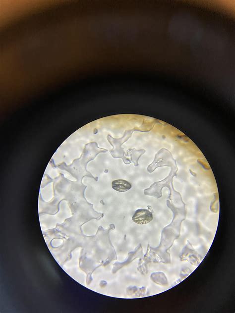 Image result for Pinworm Tape Test Procedure