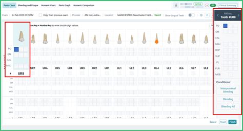 Image result for How to Perio Chart