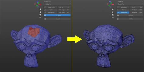 Image result for Open Mesh Repair