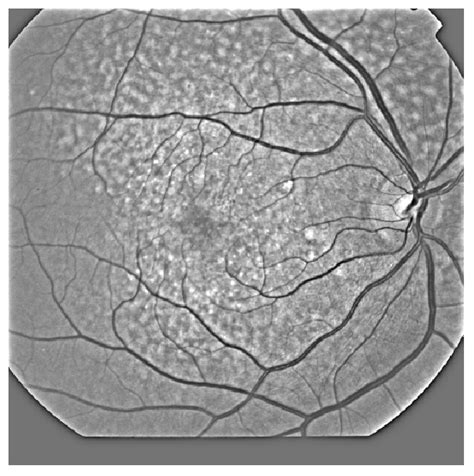 Image result for Homomorphic Filtering Test Image