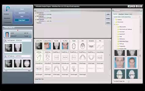 Image result for OrthoVision Dat Testing