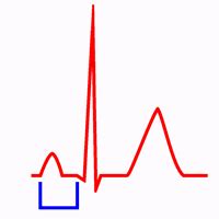 Image result for PR Interval Duration Normal