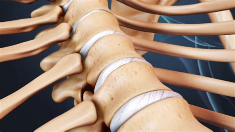 Image result for Surgery for Compression Fracture