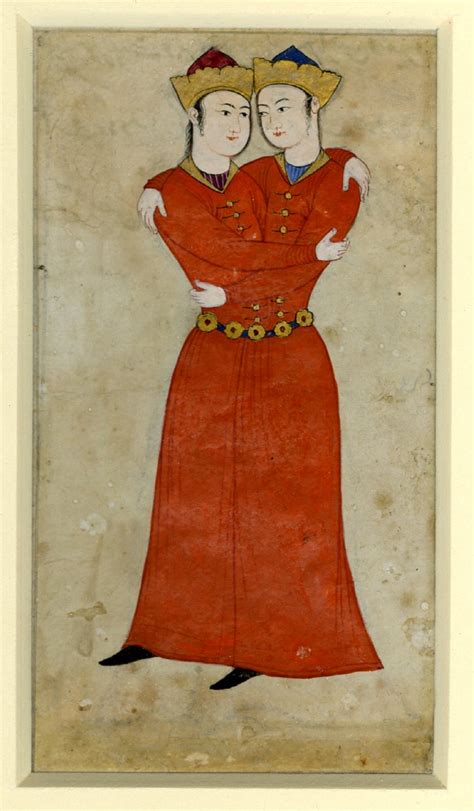 Image result for Java Island Siamese Twins