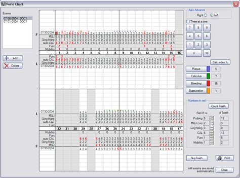Image result for Axium Perio Chart