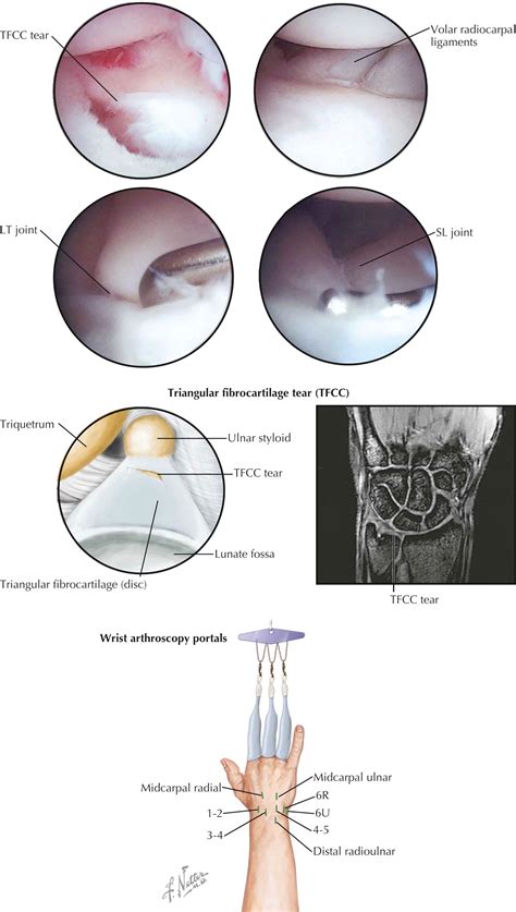 Image result for Wrist Arthrogram