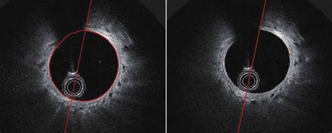 Image result for Oct Check