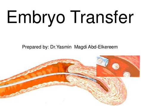 Image result for Embryo Transfer Technology
