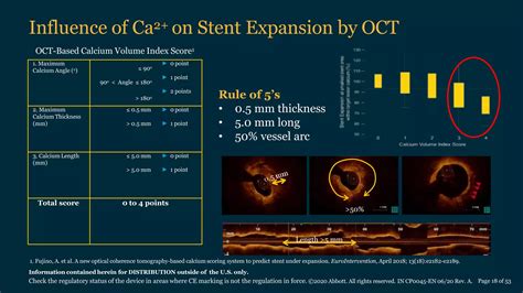 Image result for Oct Interpretation Guide