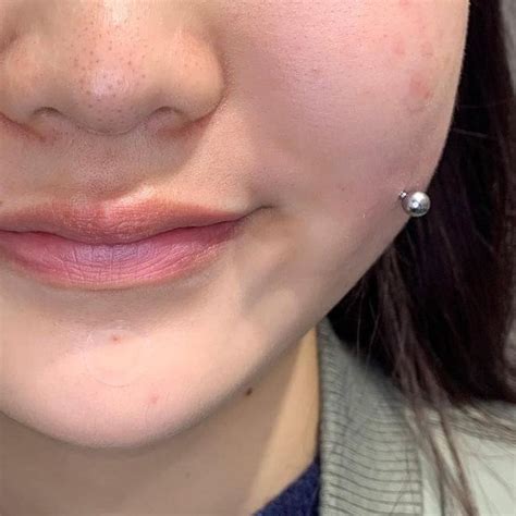 Image result for Cheek Piercing Risks